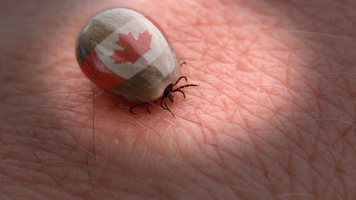Ticks Creep Into Canada, With Lyme Disease (and Confusion) In Tow