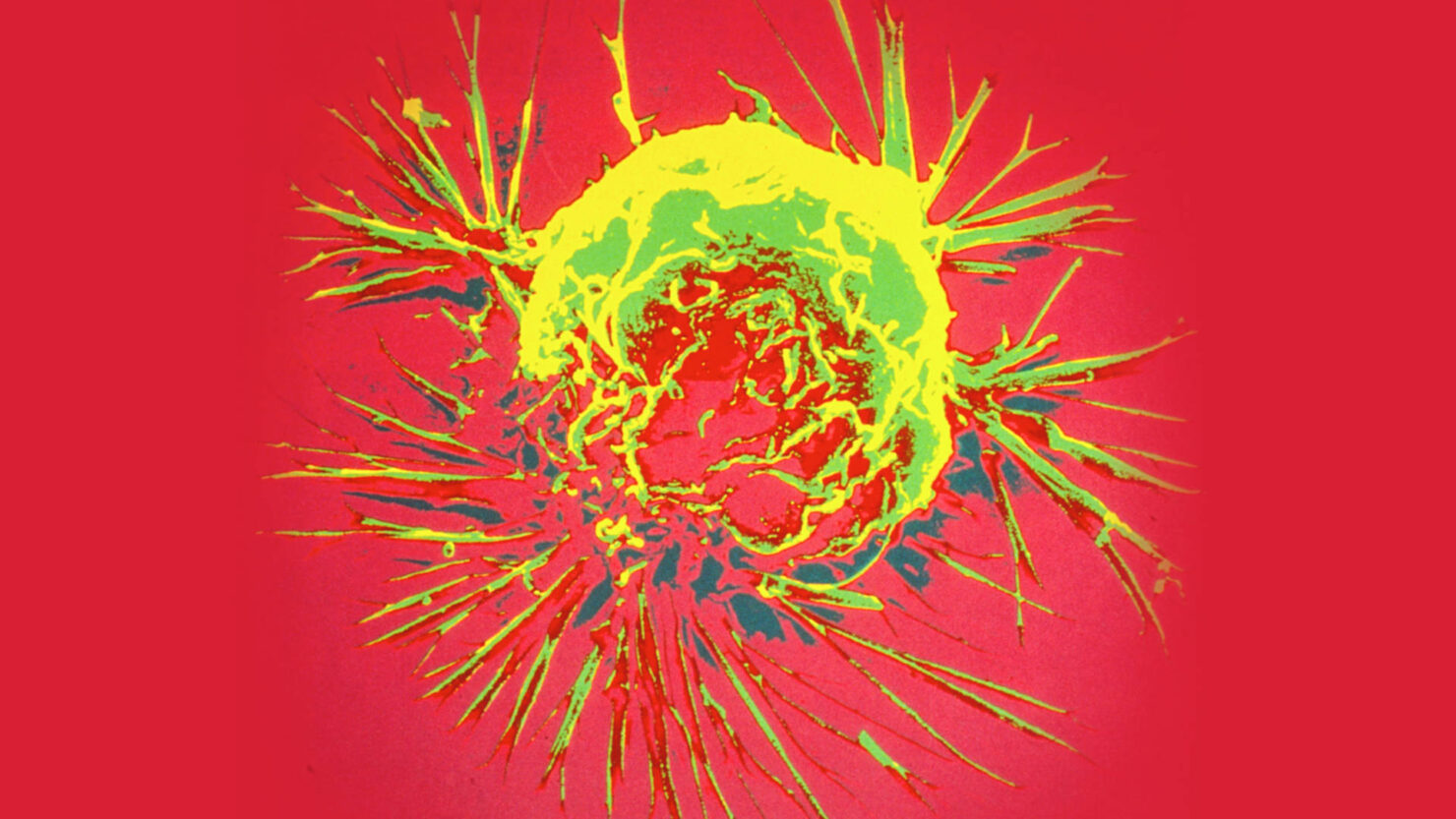 Book Review: How to Confront the Fear of Cancer