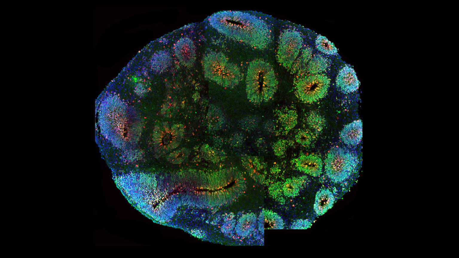 As Brain Organoid Science Grows More Complex, So Do the Questions